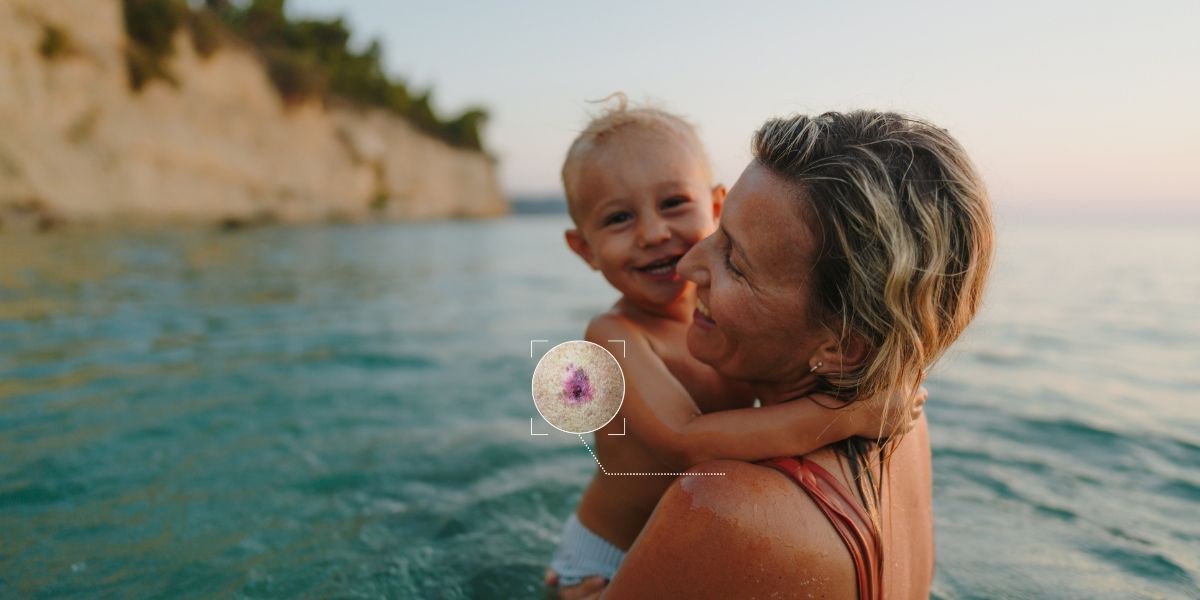 SkinTracker™ | Exclusive to Skin Institute | Enquire Now